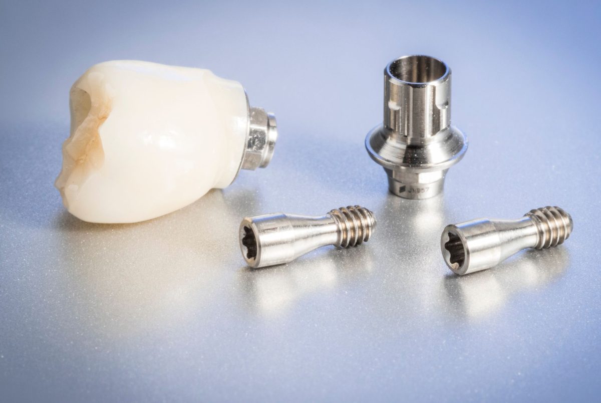 KISS principle for dental implants | Modern Dental Pacific
